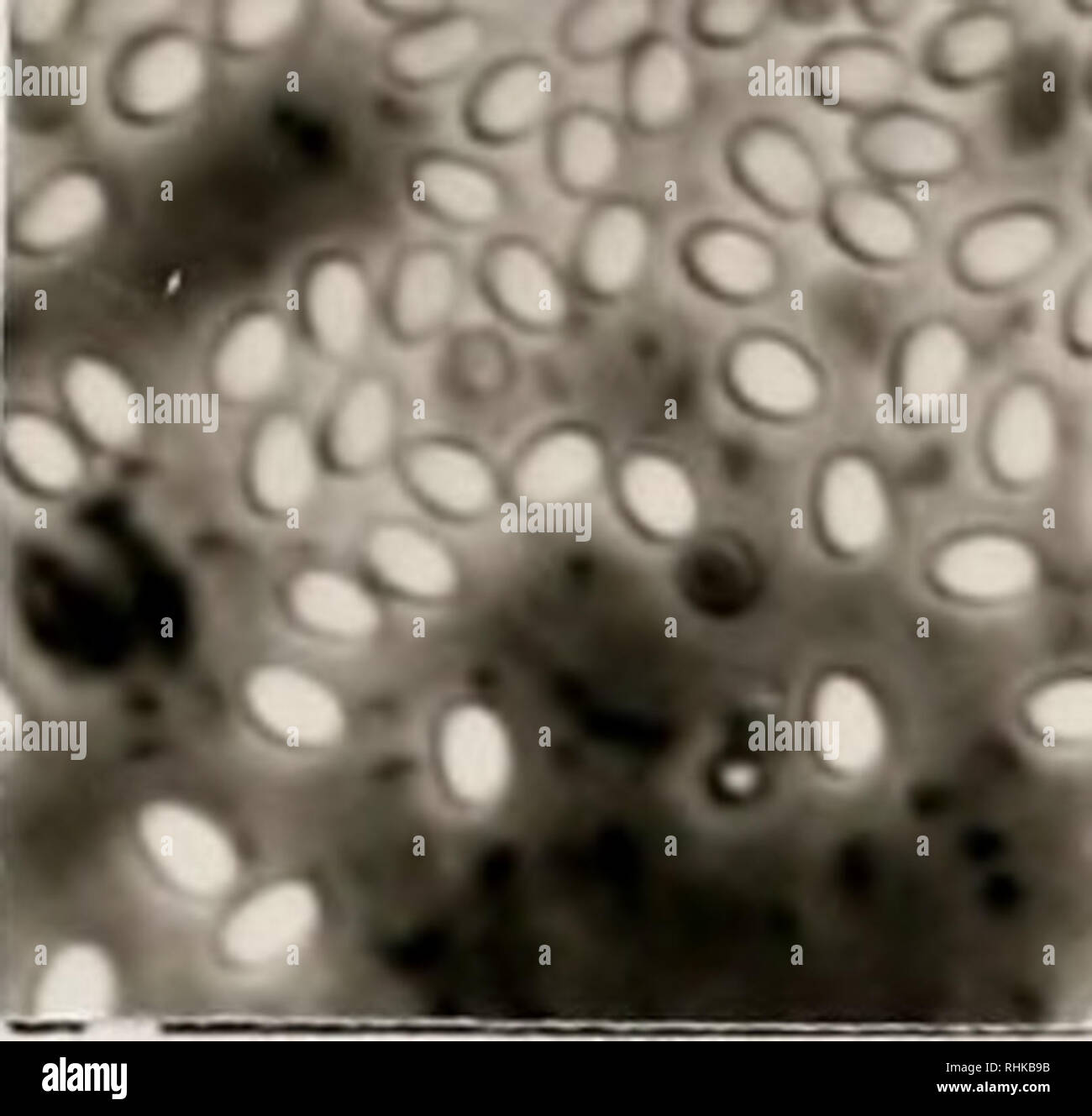 Leishmaniose cutanée Banque de photographies et d’images à haute ...