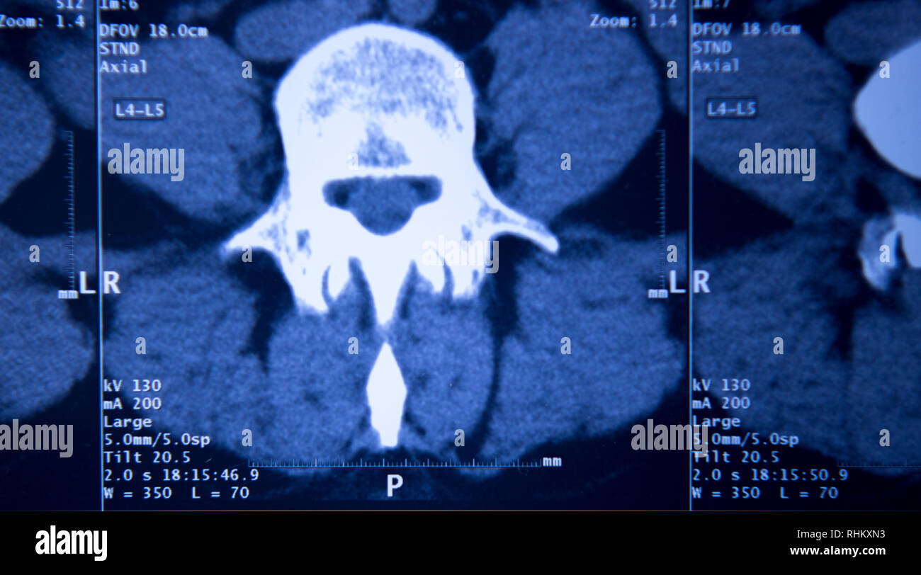 X-ray hôpital médical rachis bassin hanches traumatologie IRM scan ...