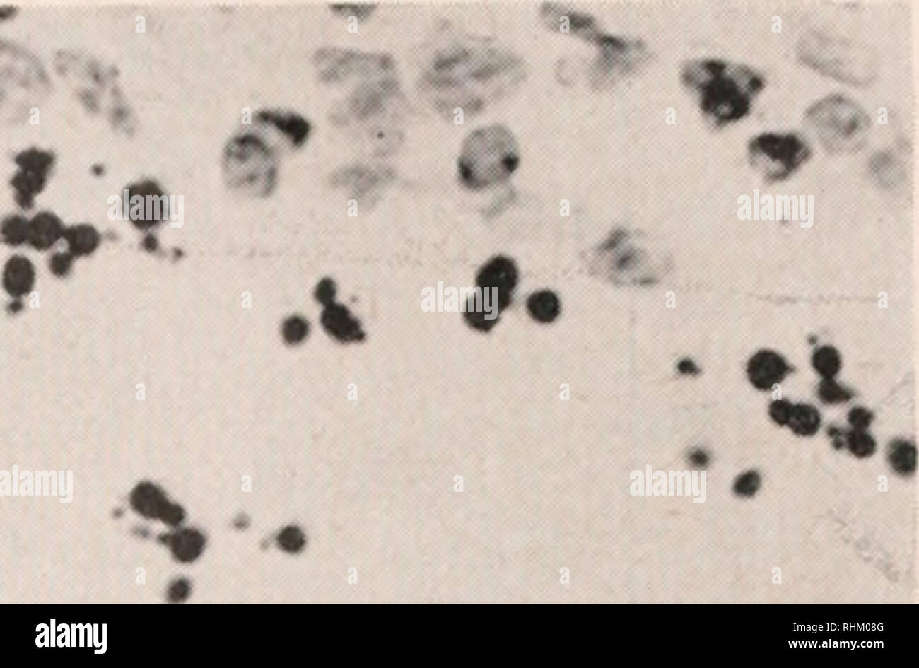 Protein staining Banque de photographies et d’images à haute résolution ...
