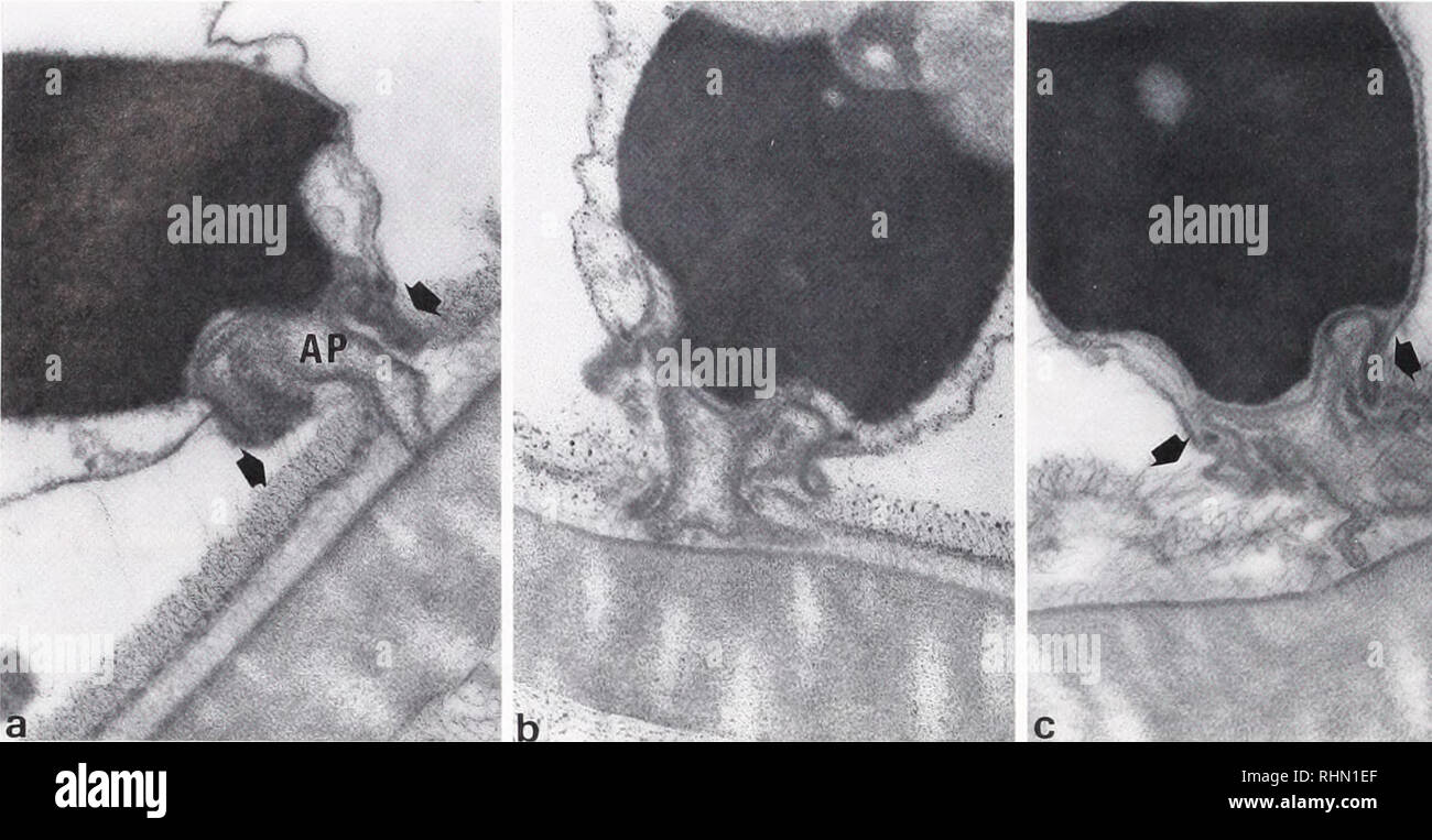 Spermatozoïde microscope électronique Banque de photographies et d ...