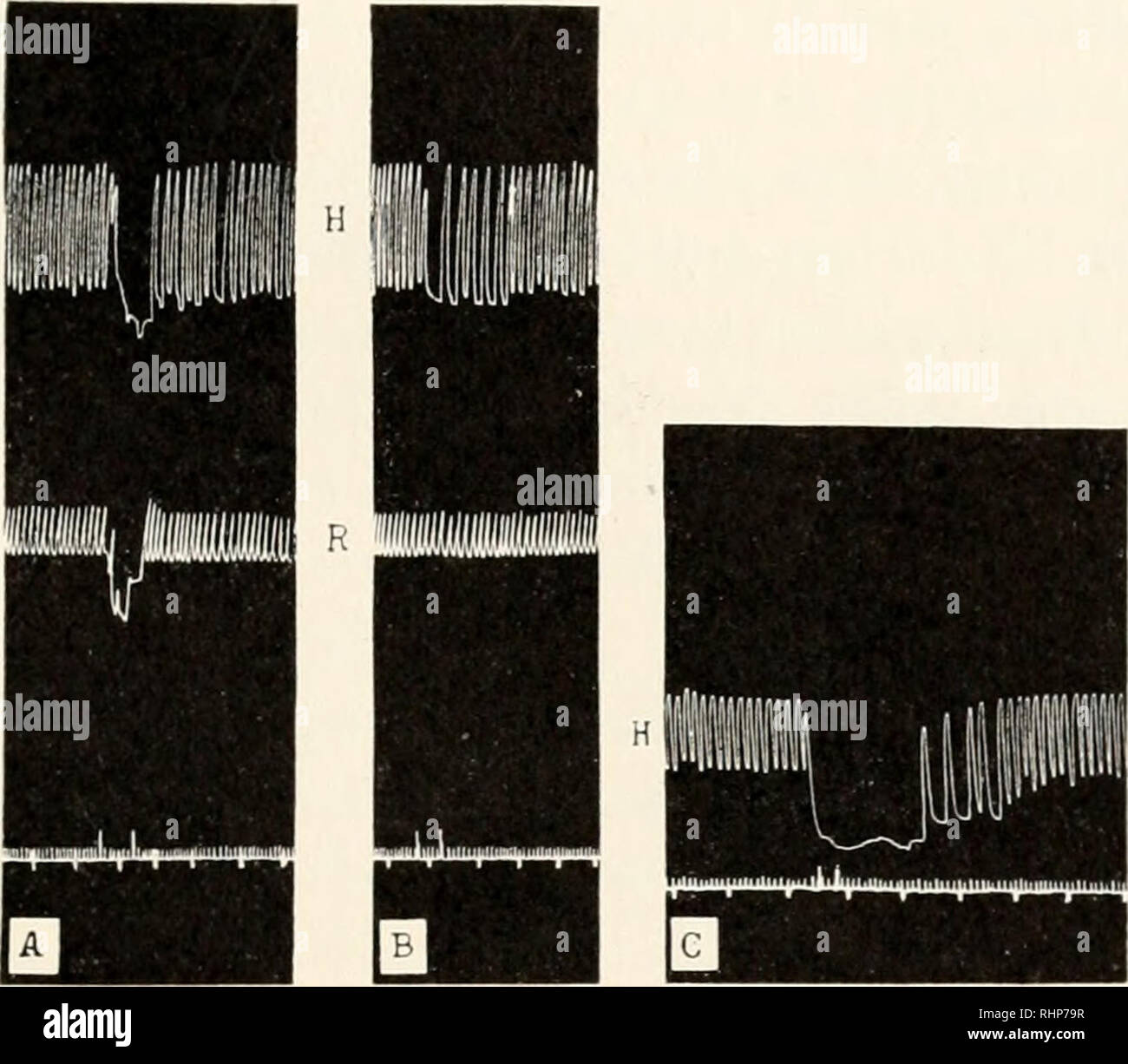 Innervation cardiaque Banque de photographies et d’images à haute ...