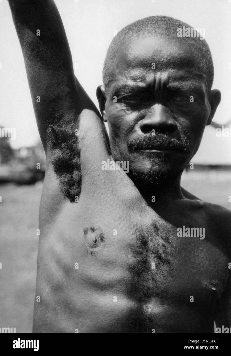 Aisselle homme poilus Banque de photographies et d’images à haute ...
