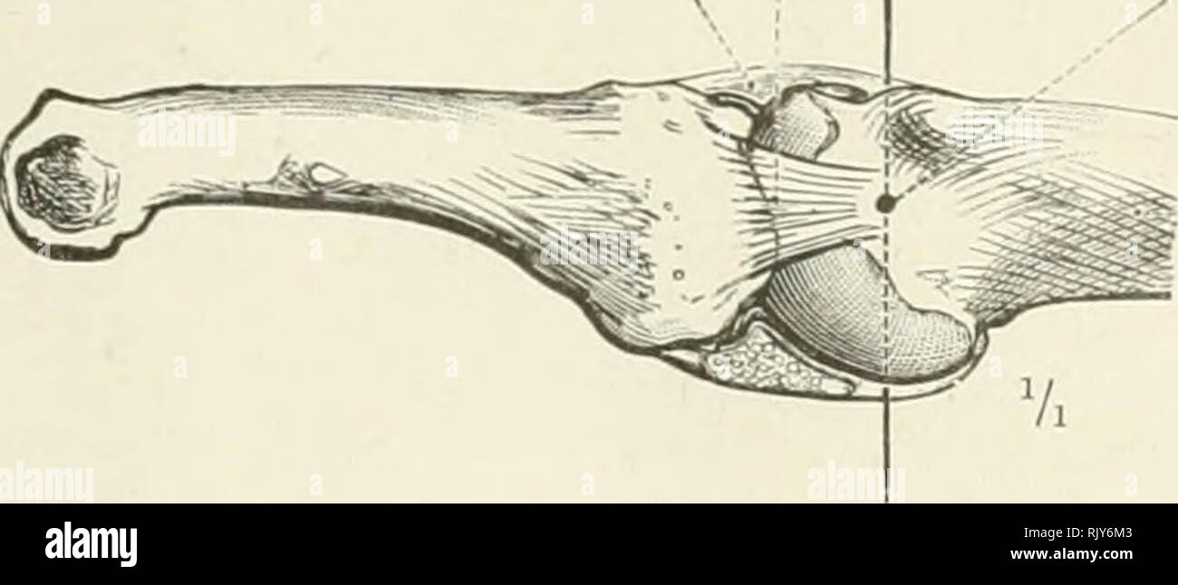 Metacarpo phalangeal joint Banque de photographies et d’images à haute ...
