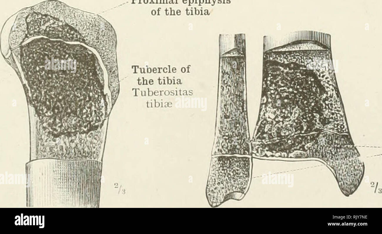 épiphyse proximal tibia Banque de photographies et d’images à haute ...