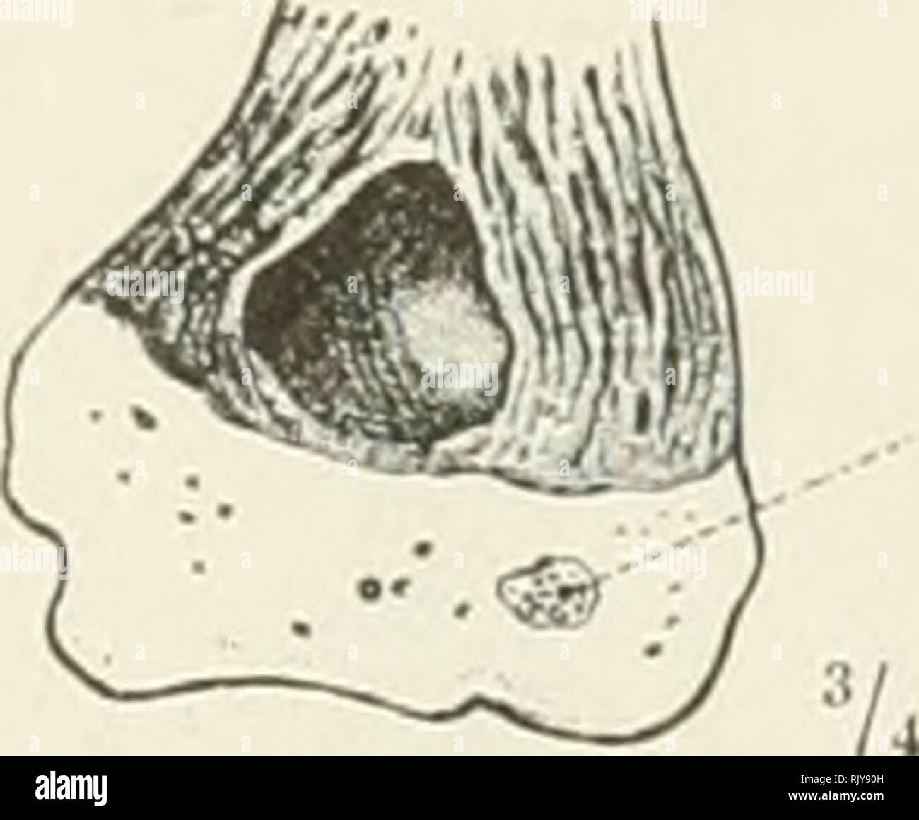 Fosse olécranienne Banque de photographies et d’images à haute résolution - Alamy