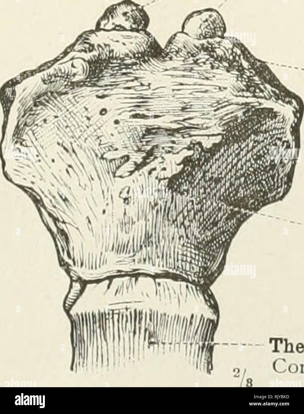 Processus xiphoïde Banque de photographies et d’images à haute ...