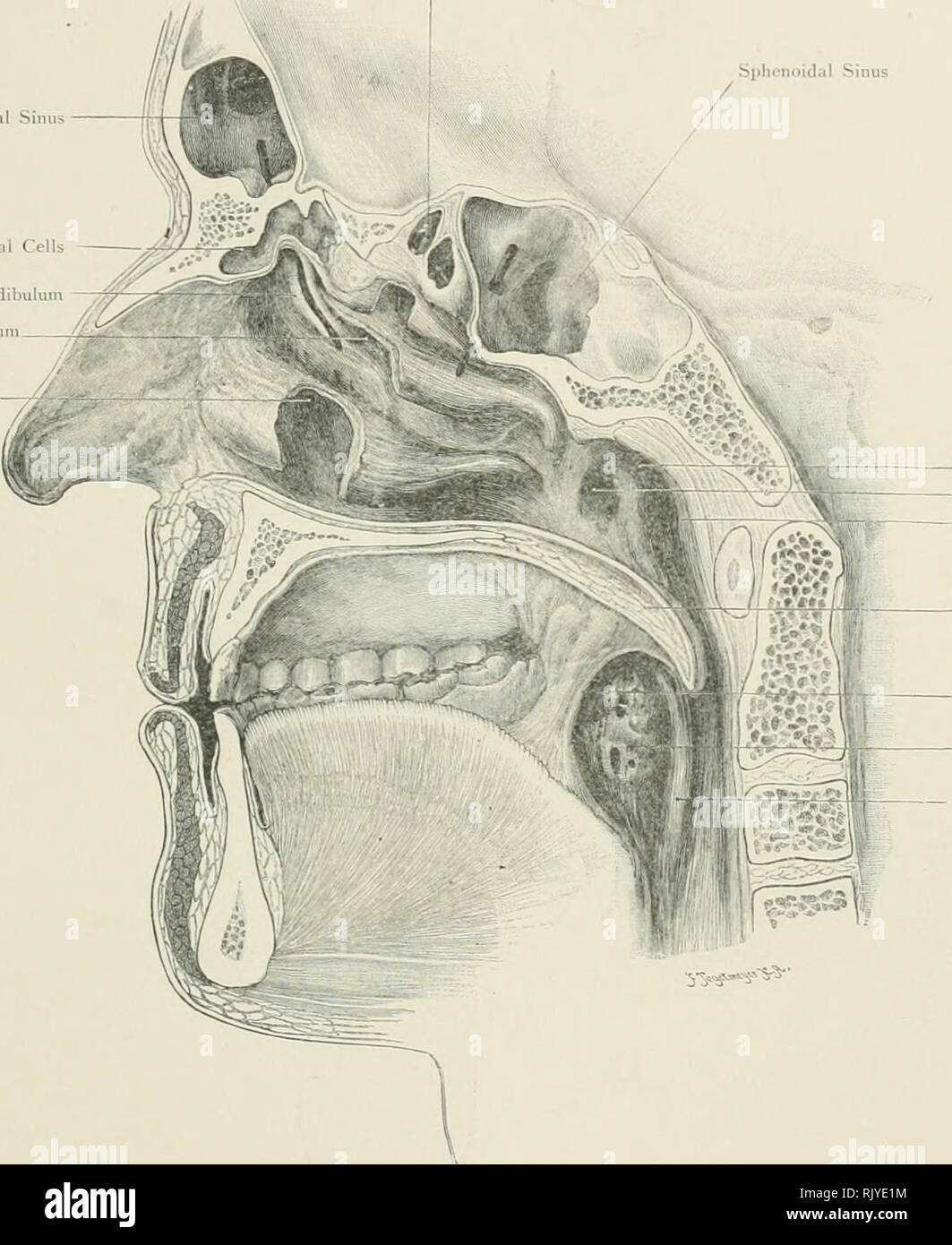 Frontal sinus cavity Banque de photographies et d’images à haute ...