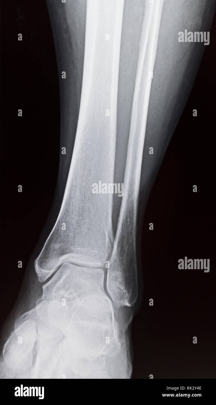 Jambes humaines Banque de photographies et d’images à haute résolution ...