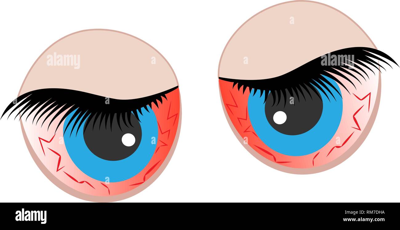 Yeux rouges caricature Banque de photographies et d’images à haute ...