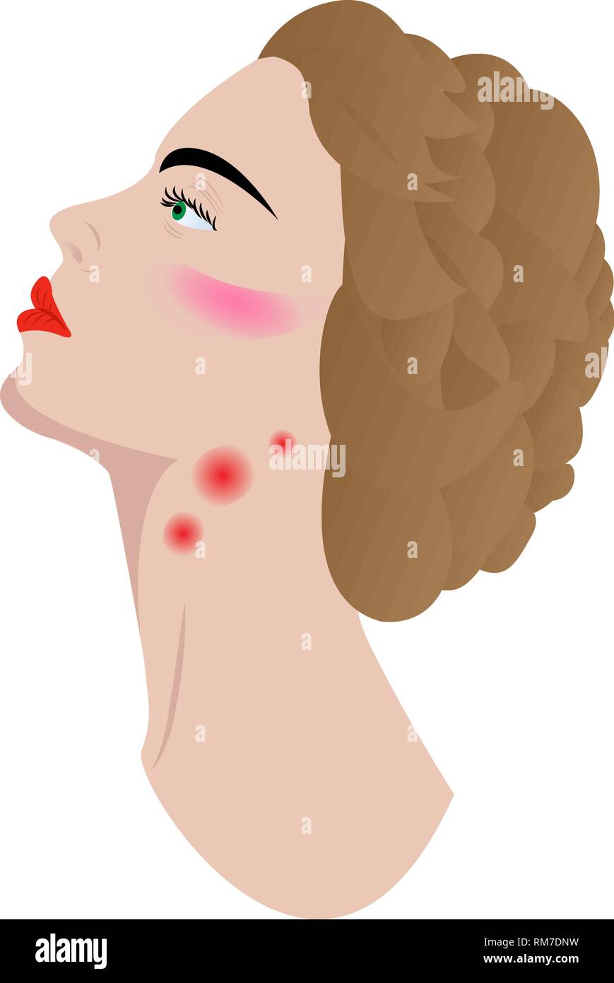 Ganglions lymphatique Banque d'images vectorielles - Alamy