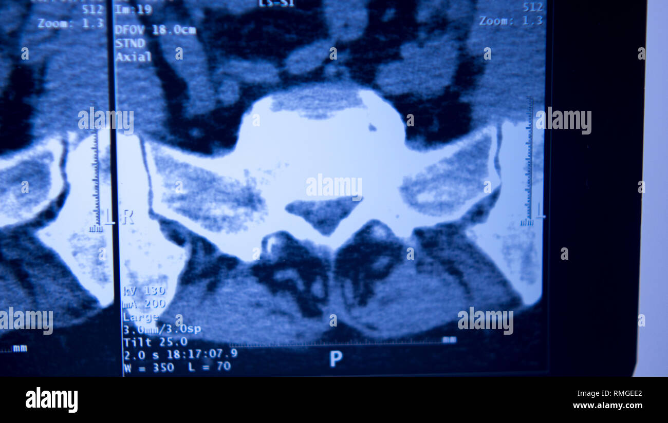 X-ray hôpital médical rachis bassin hanches traumatologie IRM scan ...