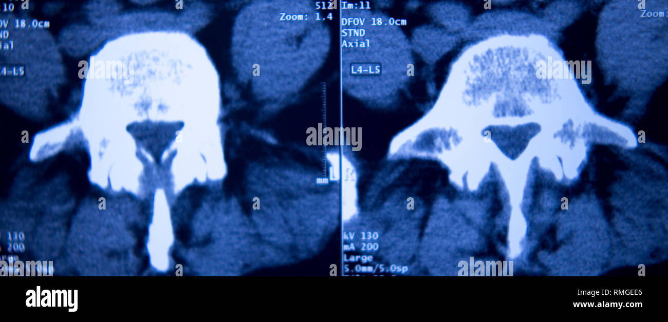 X-ray hôpital médical rachis bassin hanches traumatologie IRM scan ...