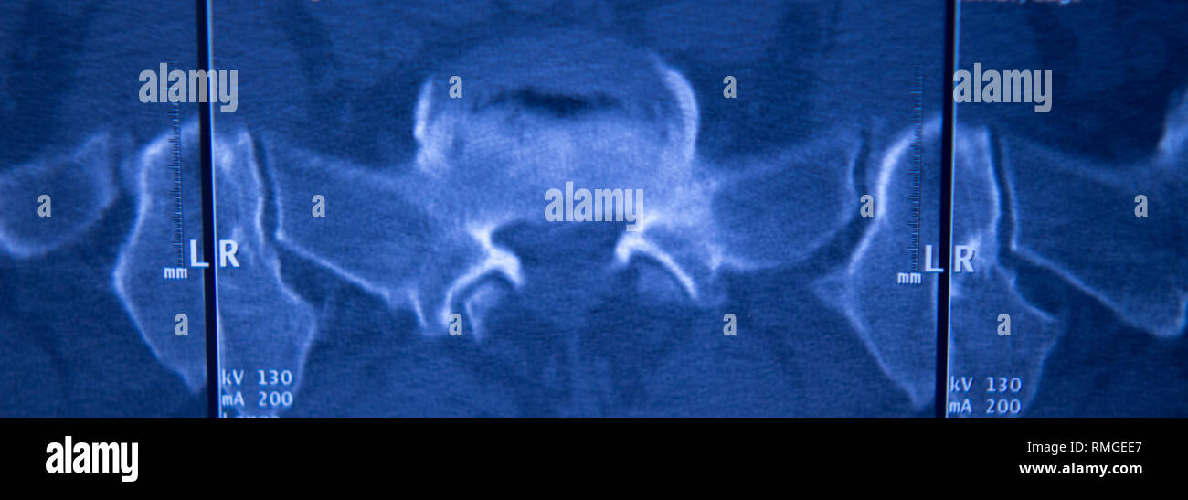 X-ray hôpital médical rachis bassin hanches traumatologie IRM scan ...