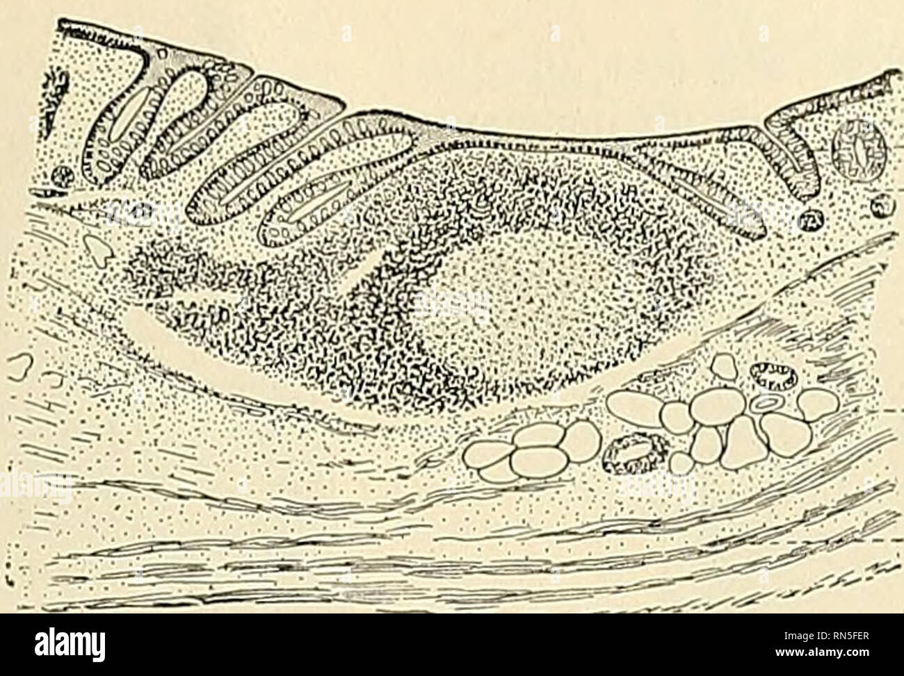 Ileocecal valve Banque de photographies et d’images à haute résolution ...