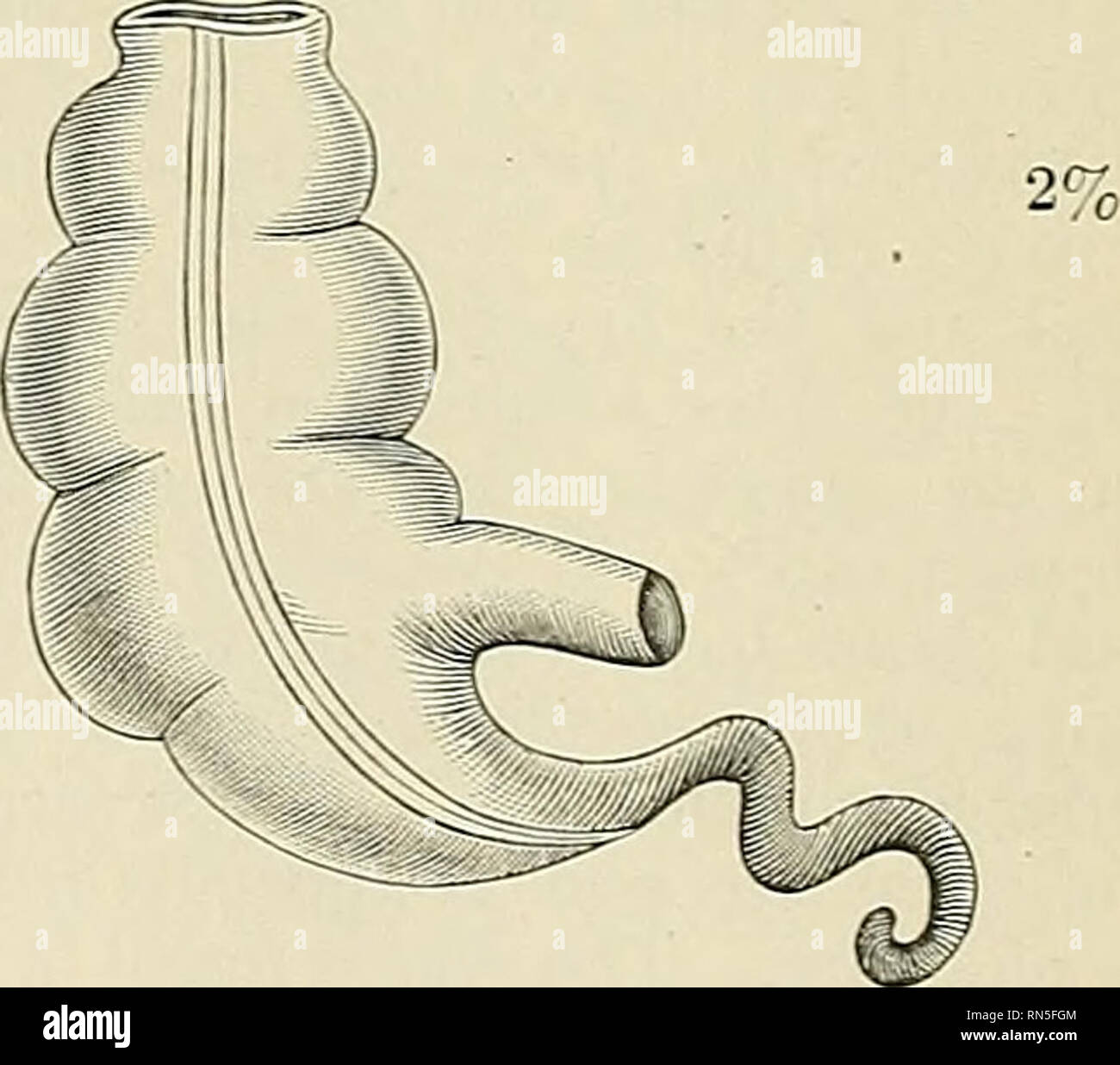 Appendix vermiformis Banque de photographies et d’images à haute ...