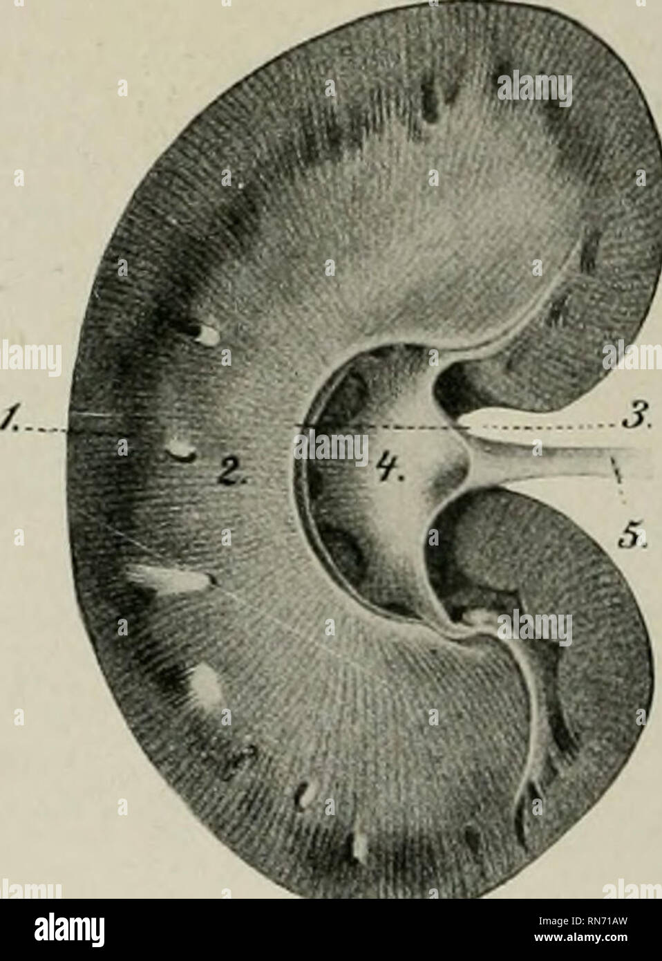 Anatomie abdominale cheval Banque de photographies et d’images à haute ...
