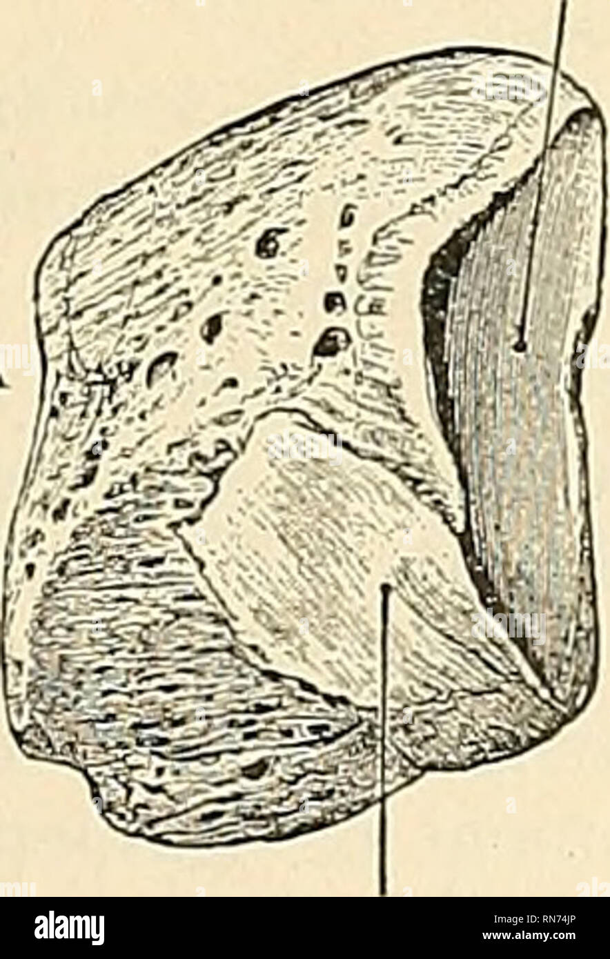 Anatomie des os du pied vue dorsale Banque de photographies et d’images ...
