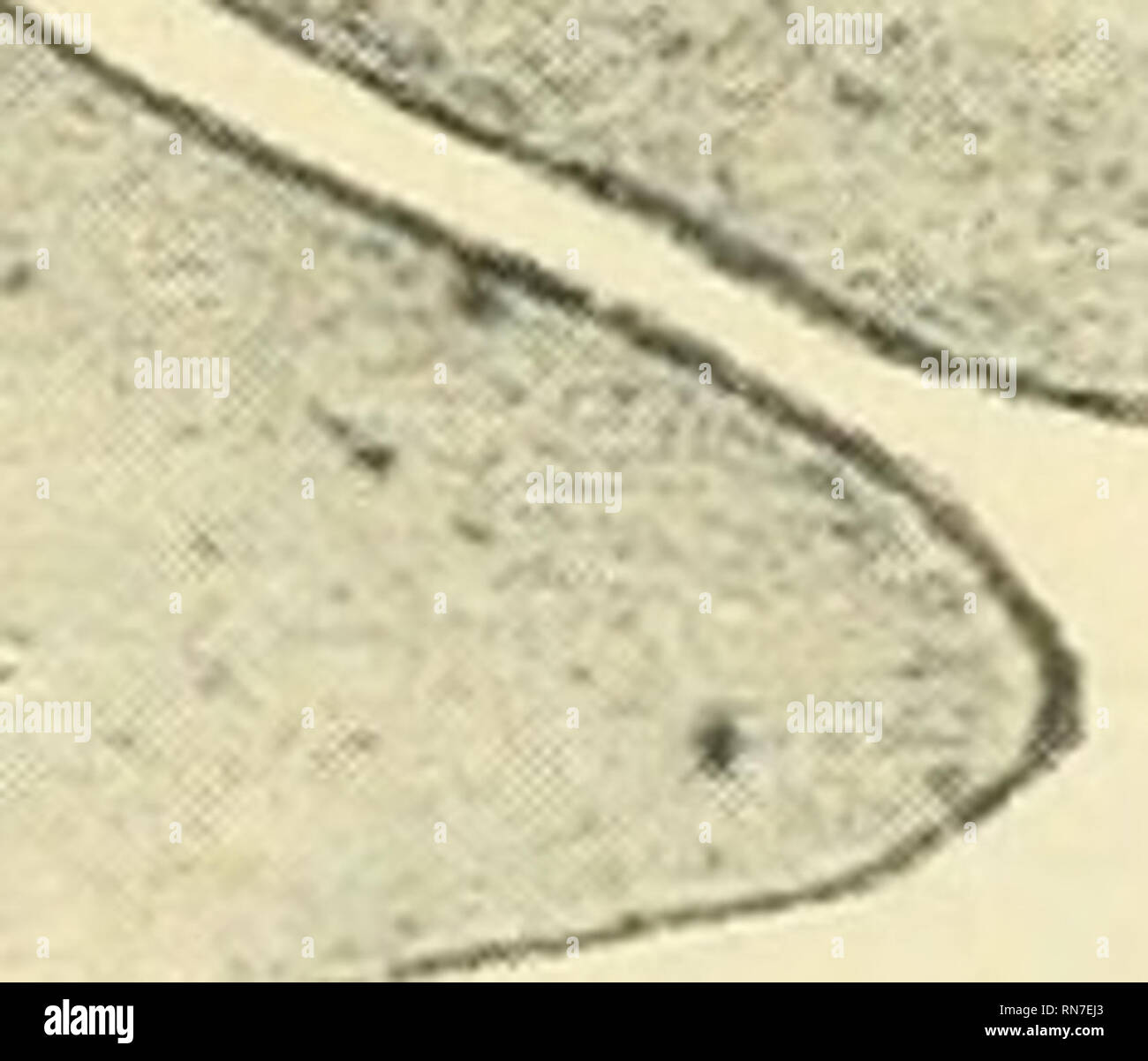 Parotis glandula Banque de photographies et d’images à haute résolution ...