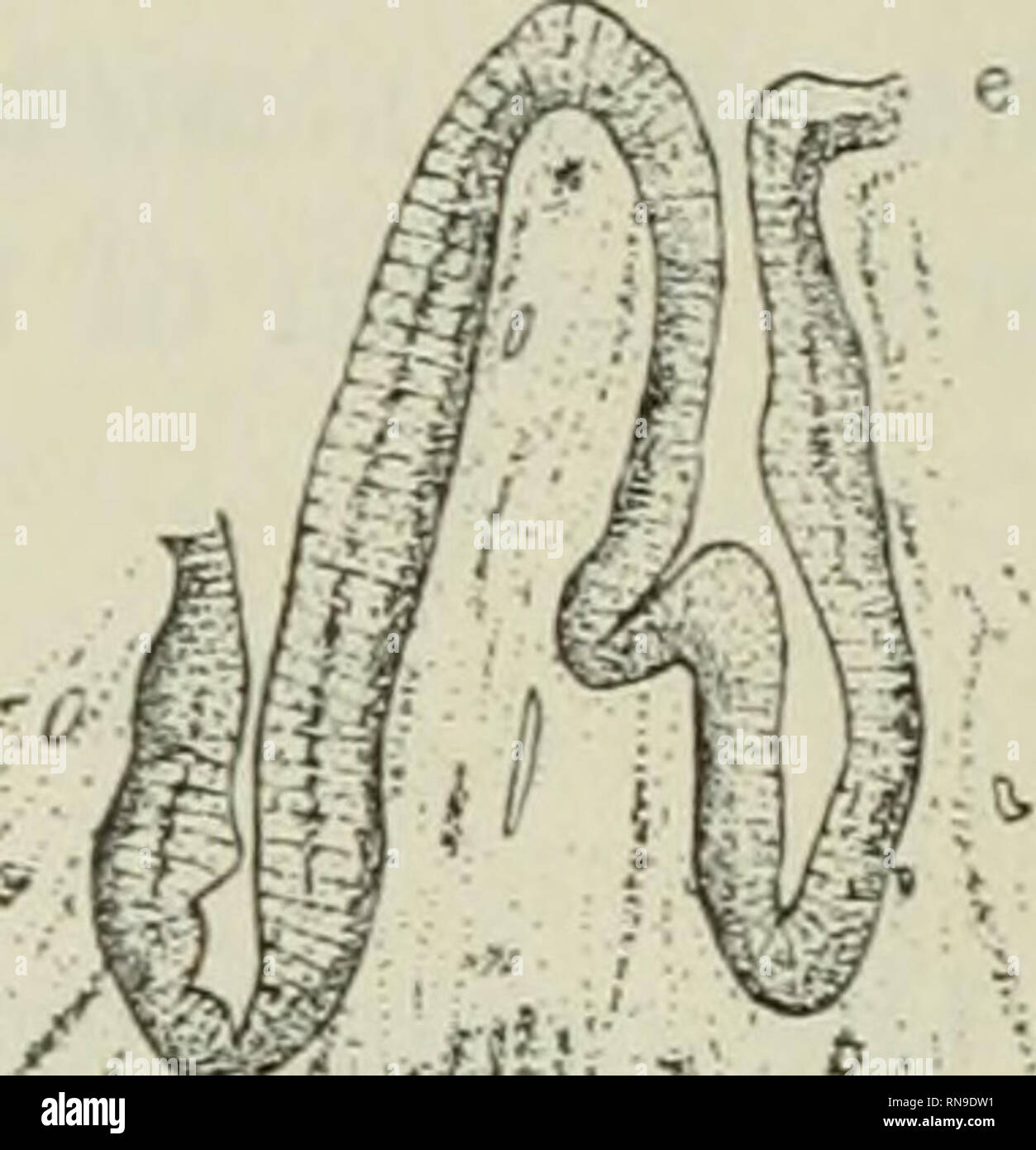 Sous muqueuse vasculaire Banque de photographies et d’images à haute ...