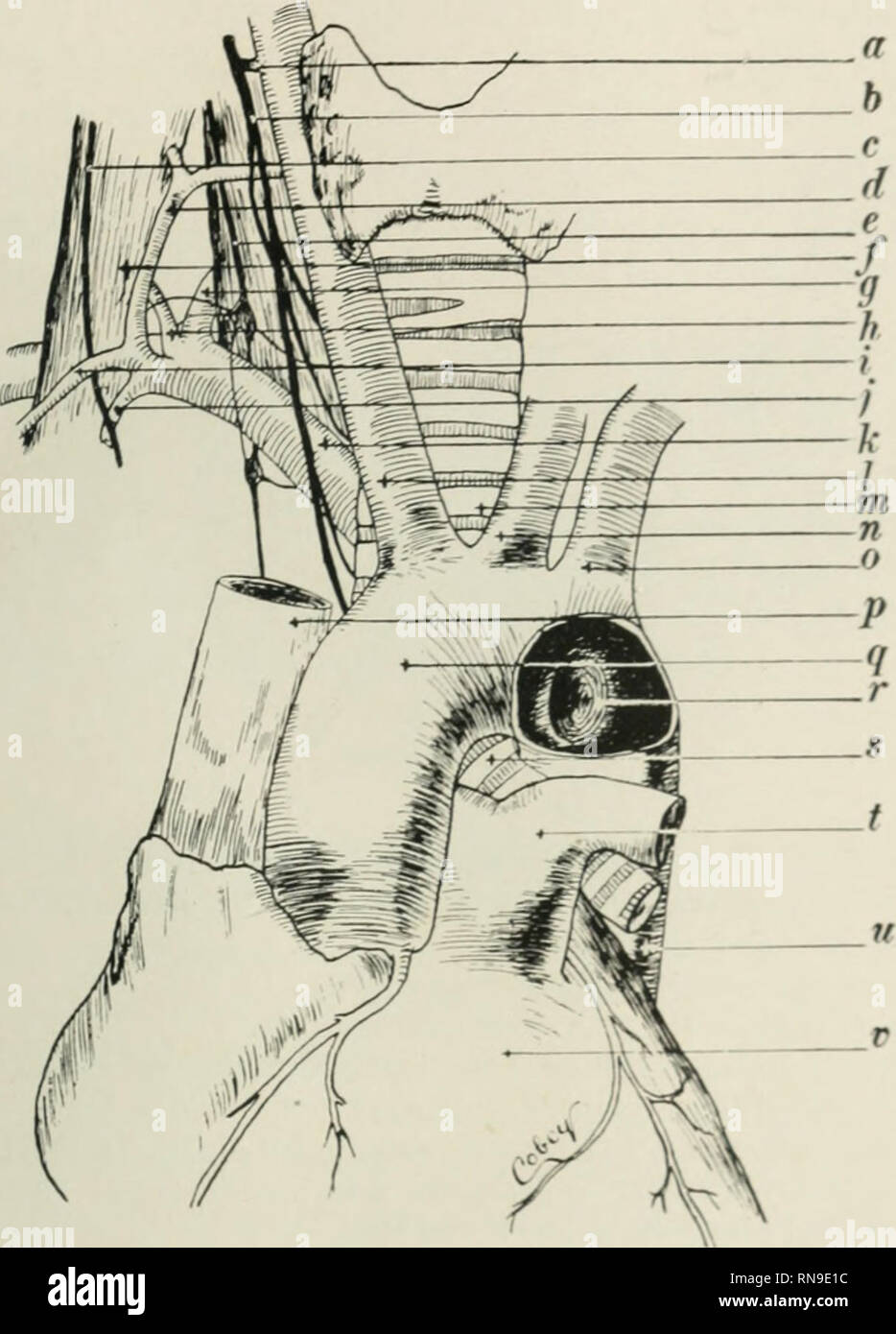 . Le dossier anatomique. Anatomie Anatomie ;. L'artère subclavière ...