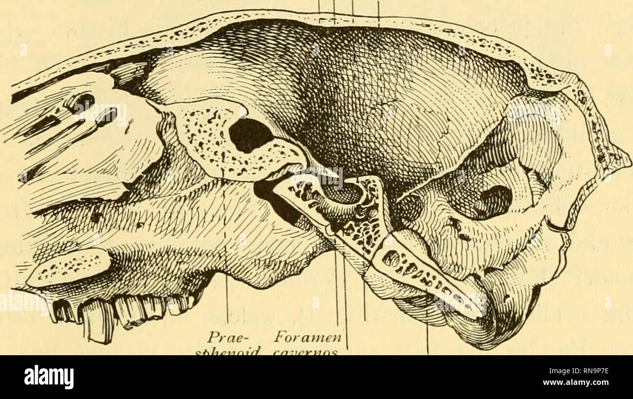 Sinus sphénoïdal Banque de photographies et d’images à haute résolution ...