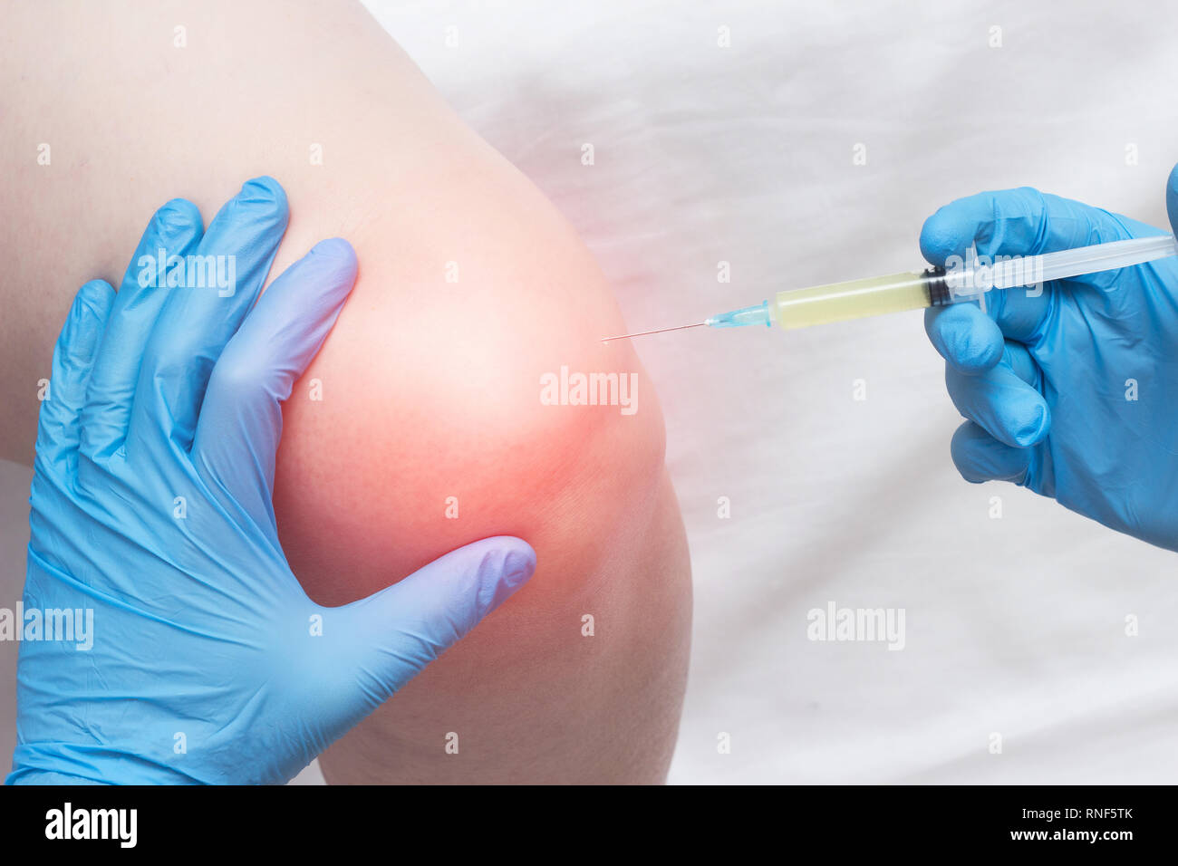 Tendinite du genou Banque de photographies et d’images à haute ...