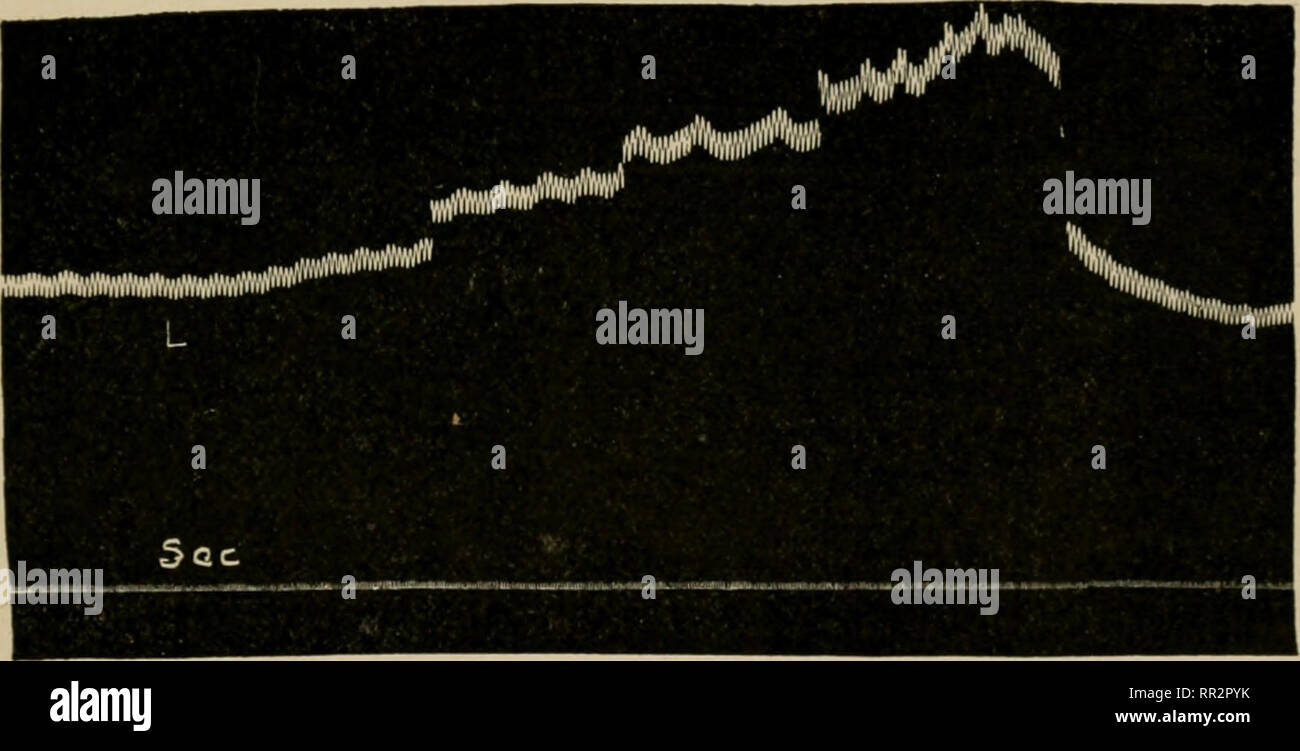 Hémorragie bras Banque de photographies et d’images à haute résolution ...