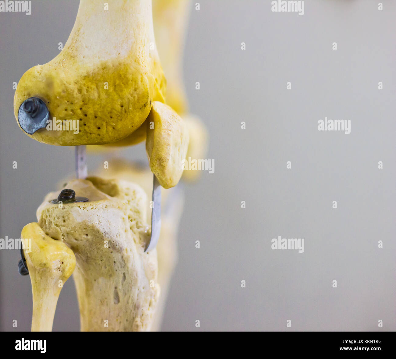 Vue côté latéral du fémur tibia péroné rotule articulée montrant les os ...