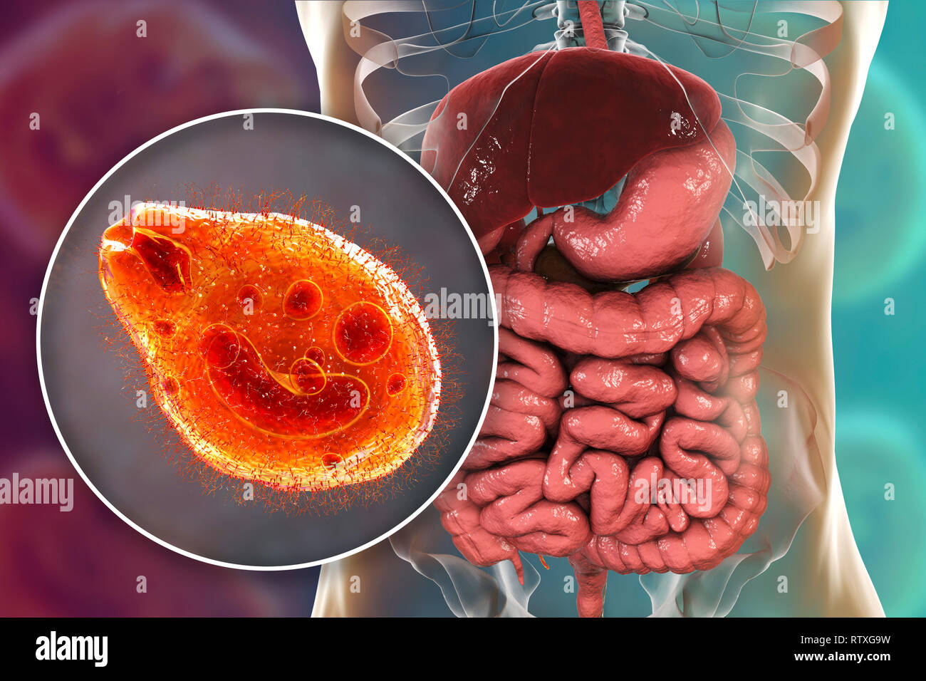 Balantidiasis, conceptual image. Illustration de l'ordinateur vue ...