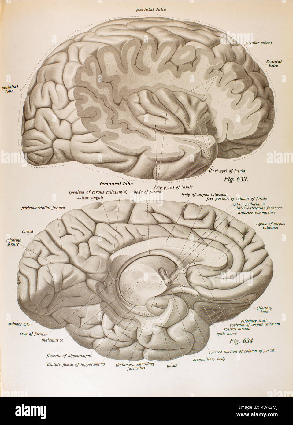 La dissection de cerveau humain montrant le lobe pariétal et temporal ...