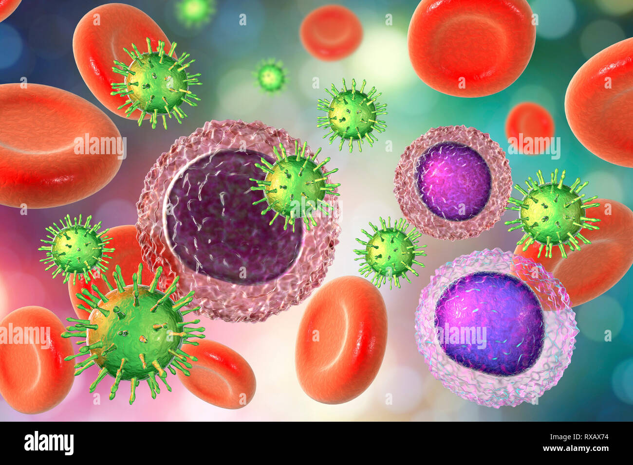 Sida infection par le virus Banque de photographies et d’images à haute ...