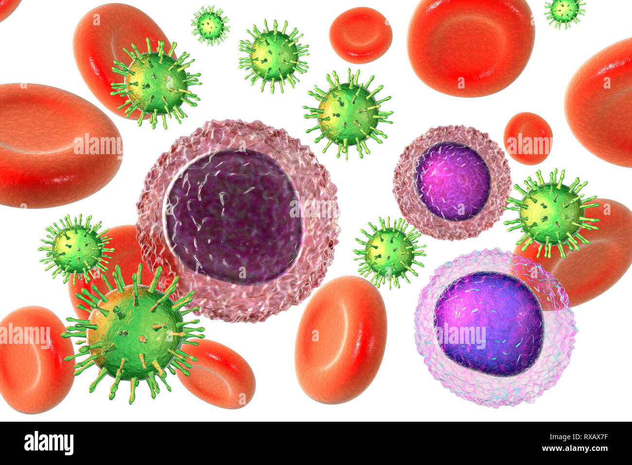 Sida infection par le virus Banque de photographies et d’images à haute ...