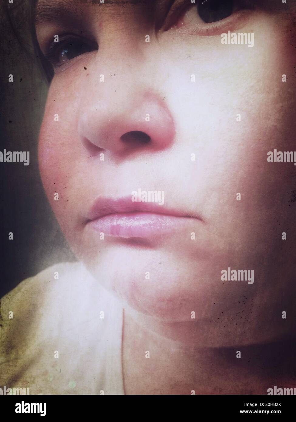 La misère : un gonflement du visage à partir d'un abcès dentaire (4 ...