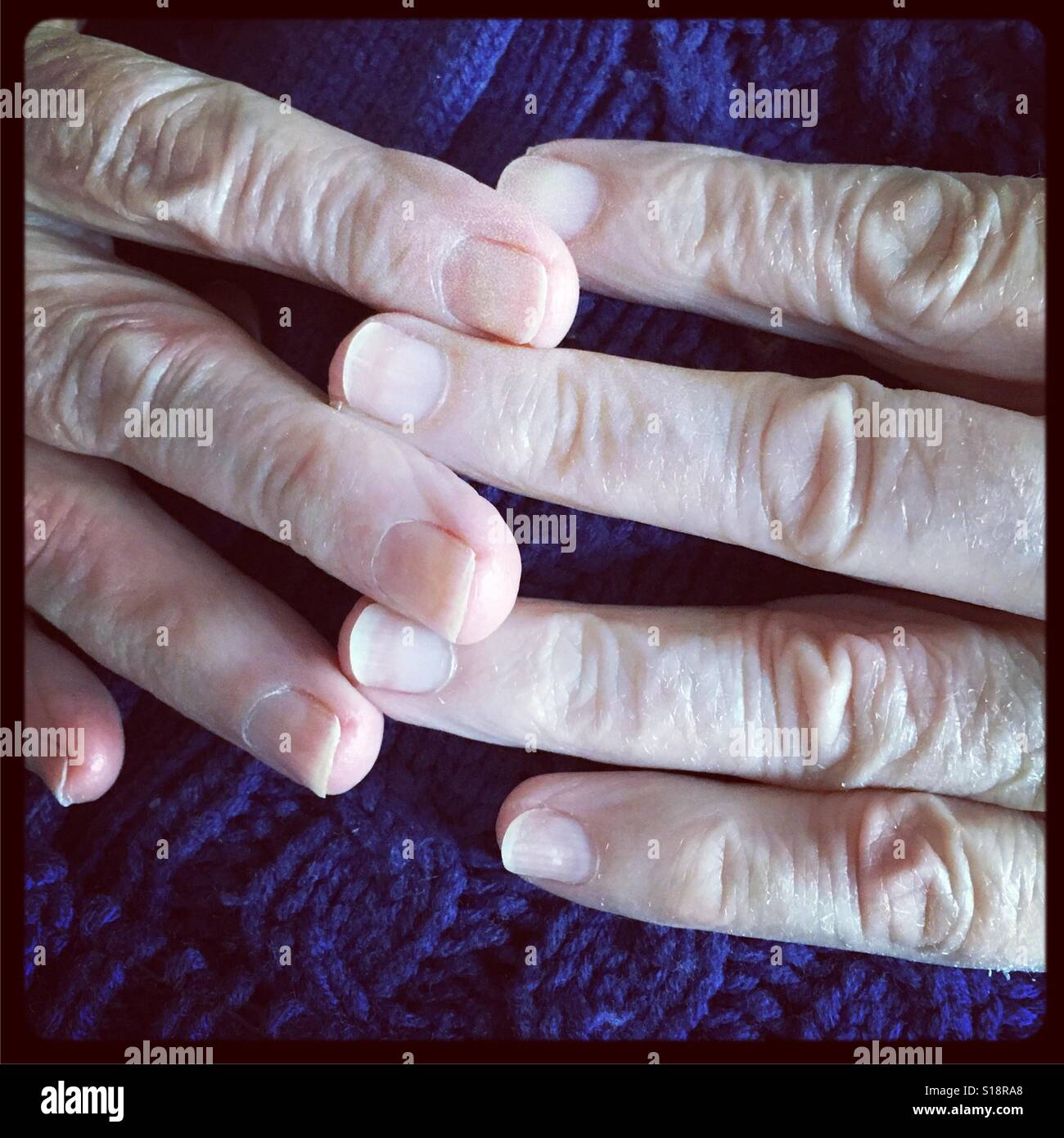 Mains froides Banque de photographies et d’images à haute résolution ...