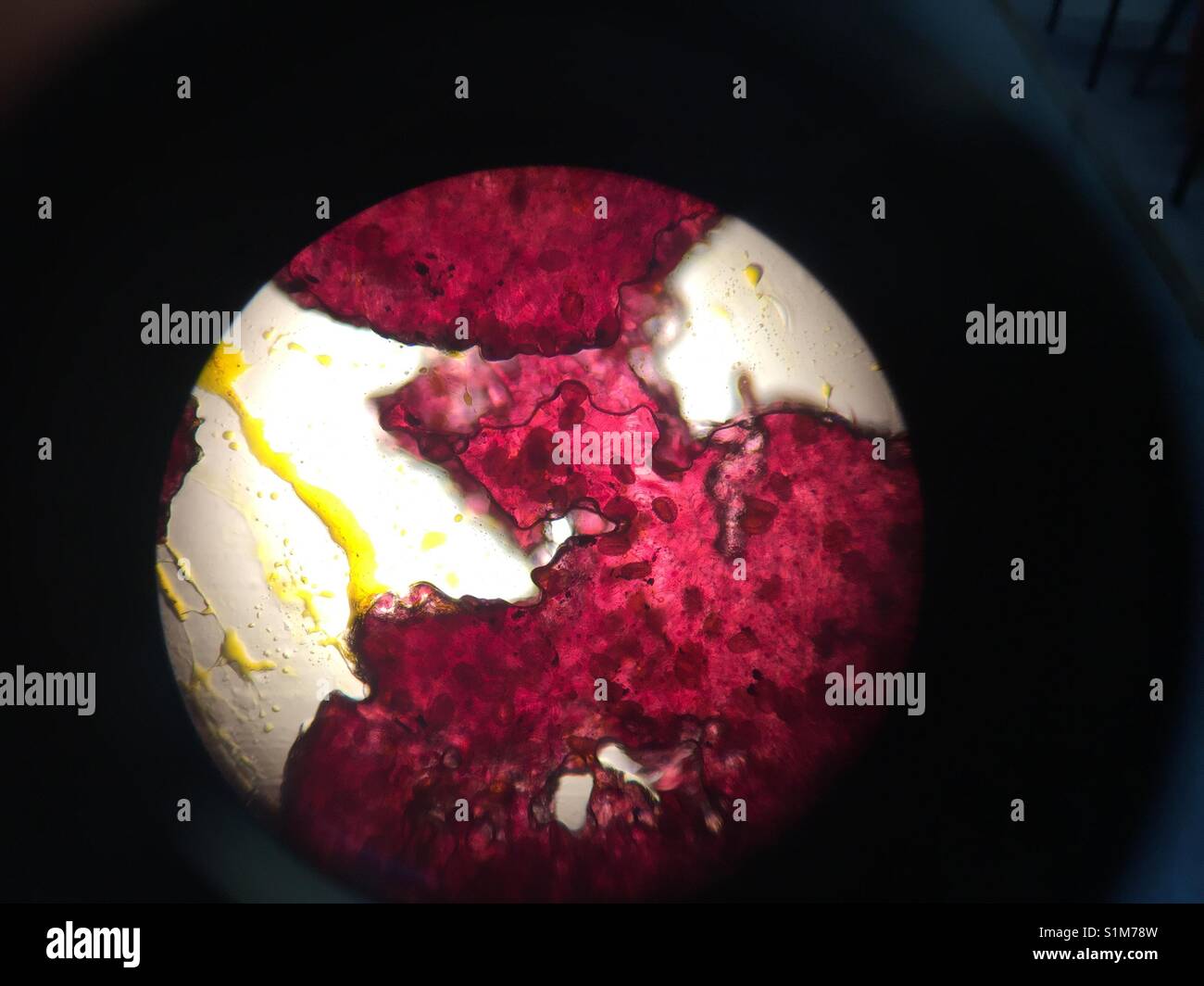 Vue microscope Banque de photographies et d’images à haute résolution ...