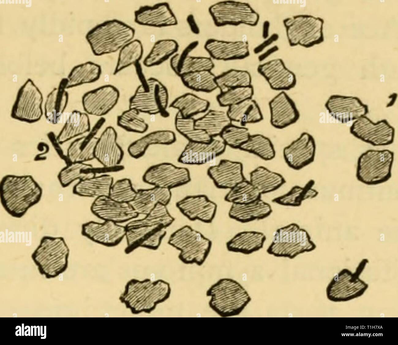 Maladies et affections des maladies et troubles de l'alimentation du ...