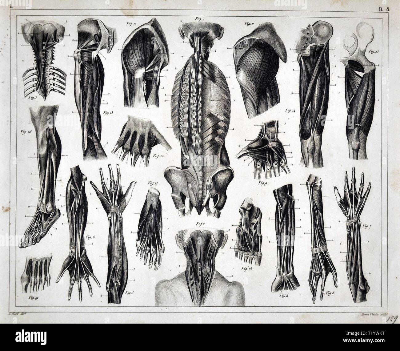 Cadavre humain Banque de photographies et d’images à haute résolution ...