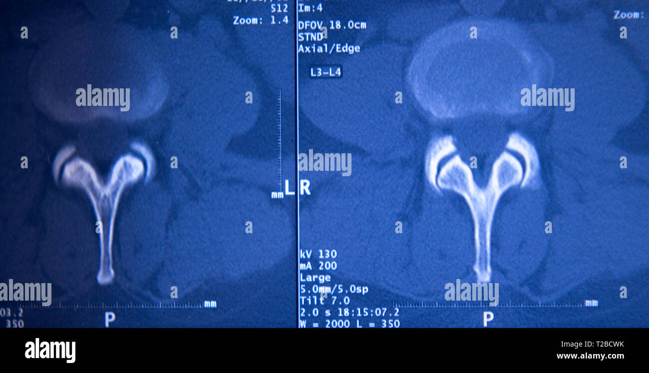 X-ray hôpital médical rachis bassin hanches traumatologie IRM scan ...
