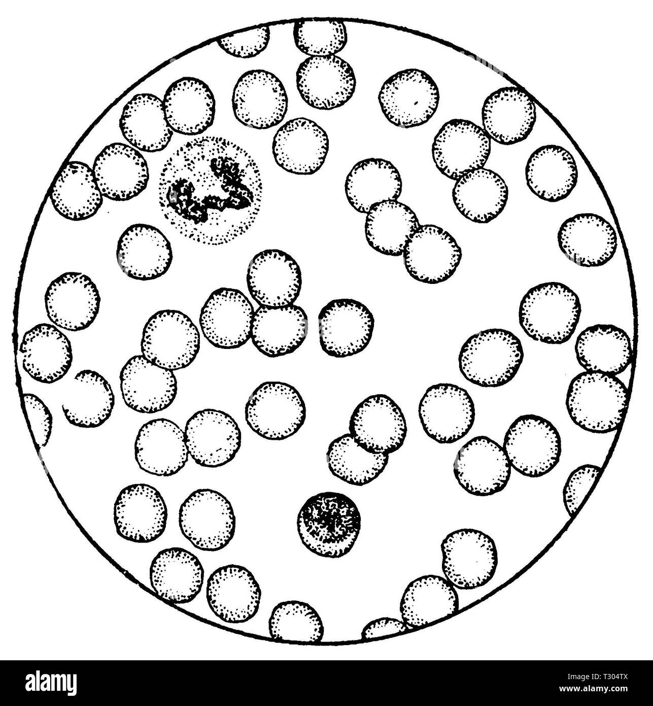 Blood under microscope Banque d'images noir et blanc - Alamy