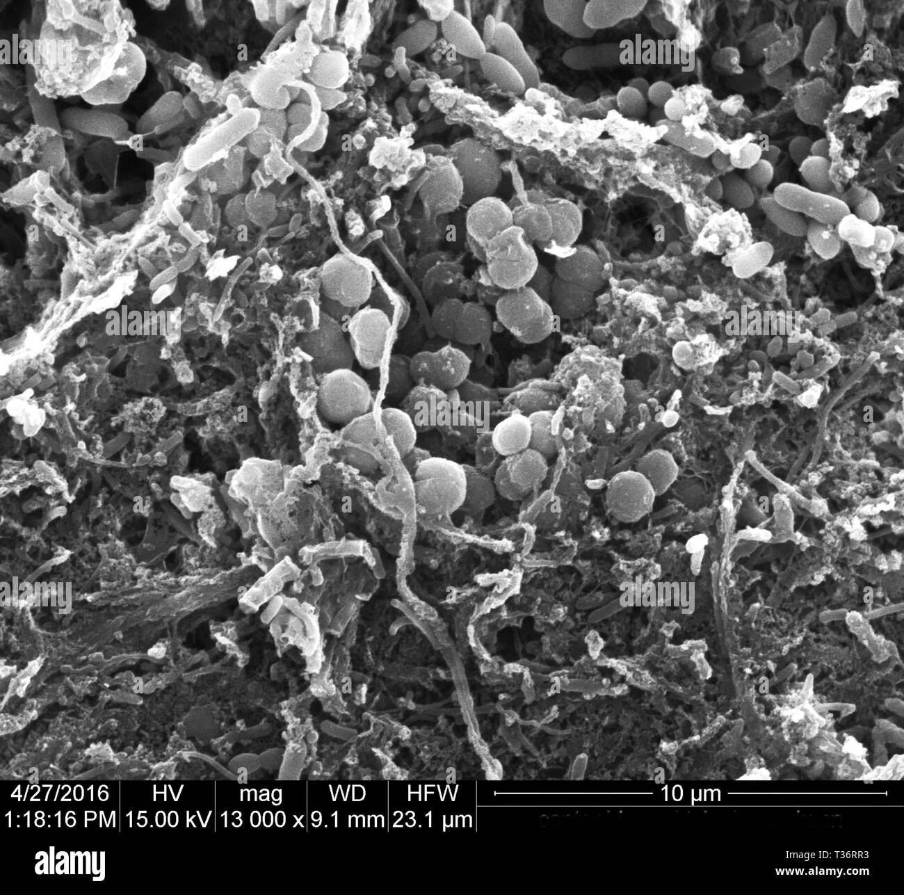 Archaea microscopy Banque de photographies et d’images à haute ...