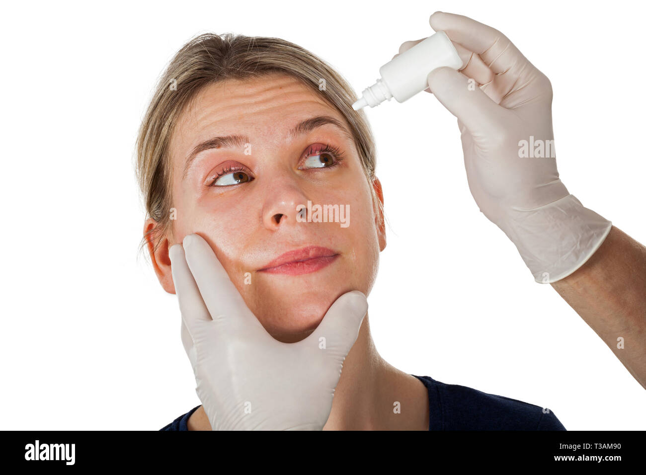 Close up photo de femme oeil infecté du patient. Sur Orgelet paupière ...