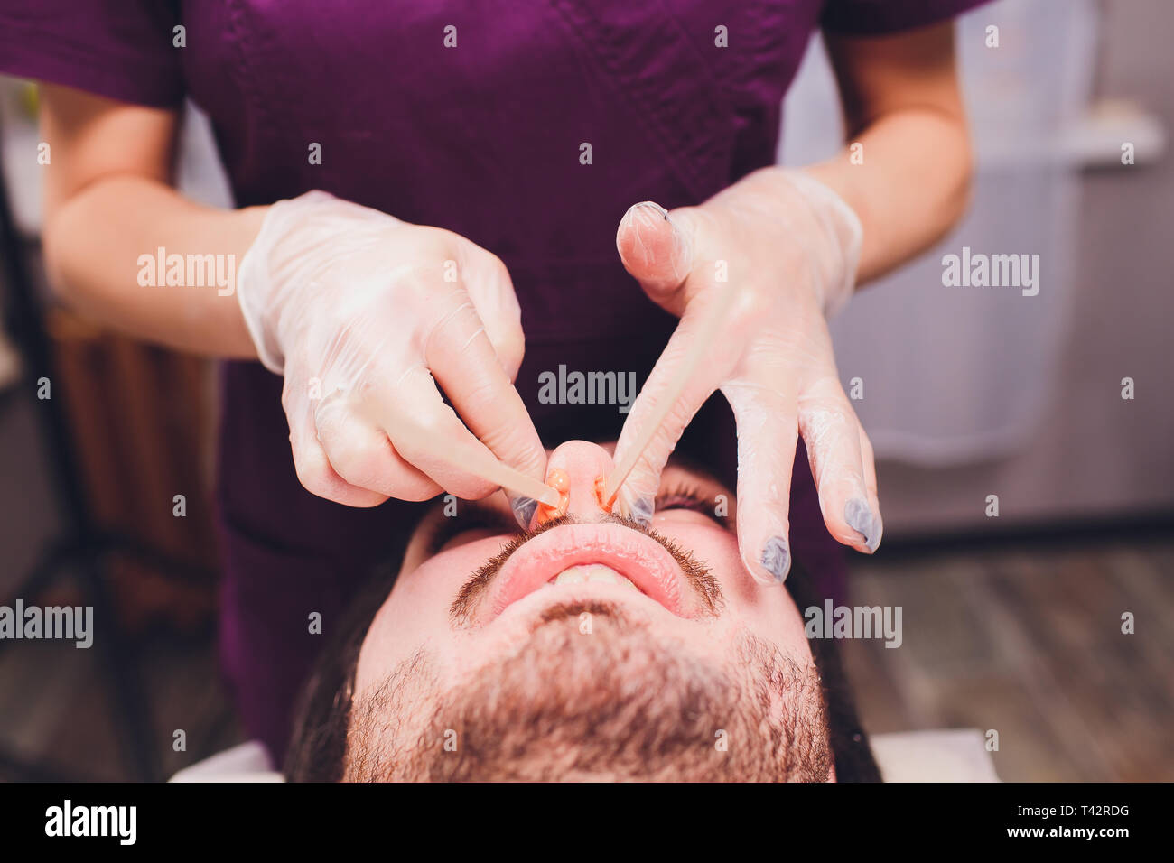 L'épilation. Visage de l'homme epilationsy ellow cabane en cosmétologie ...