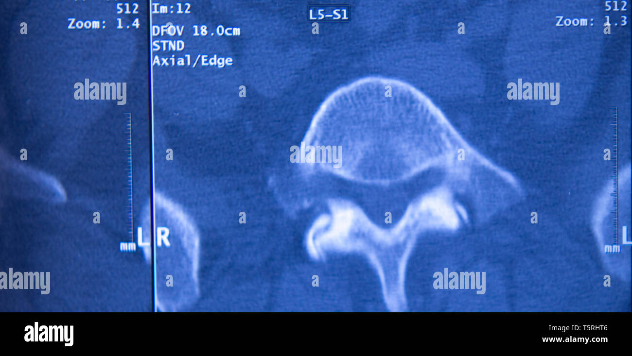 X-ray hôpital médical rachis bassin hanches traumatologie IRM scan ...