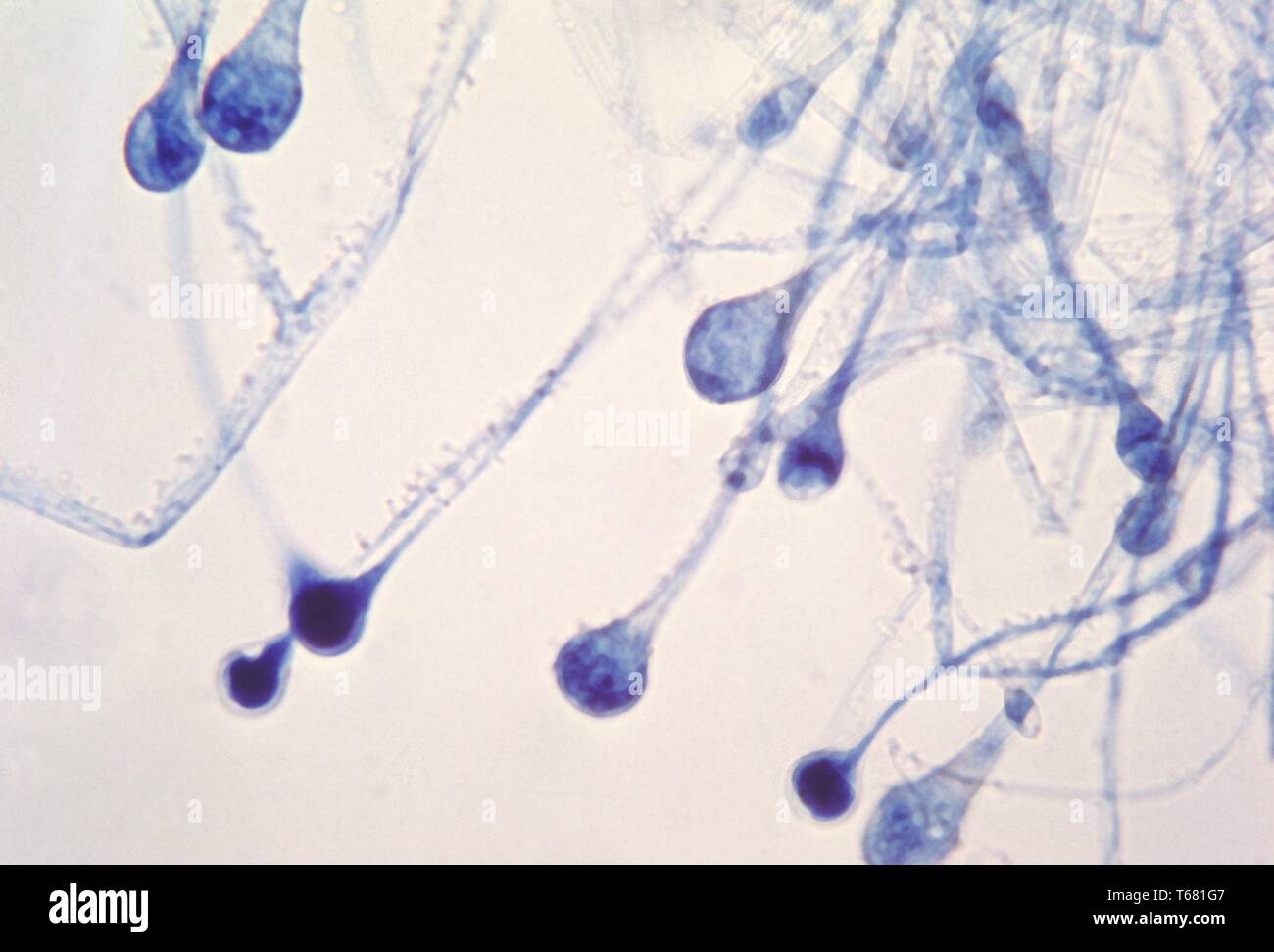 Photomicrographie de sporanges de jeunes l'espèce Mucor champignon ...