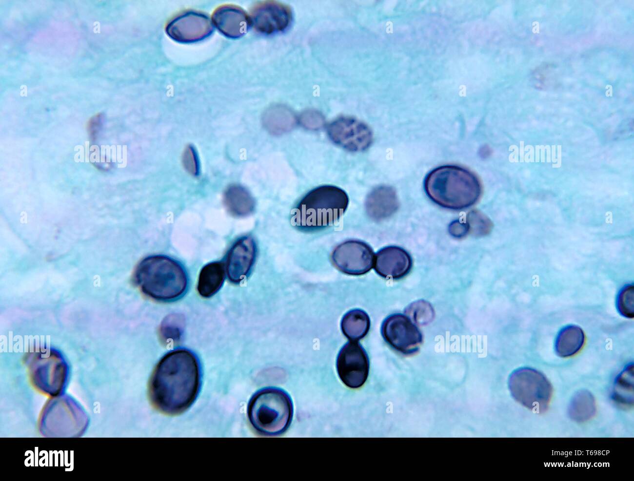 Histoplasma duboisii Banque de photographies et d’images à haute ...