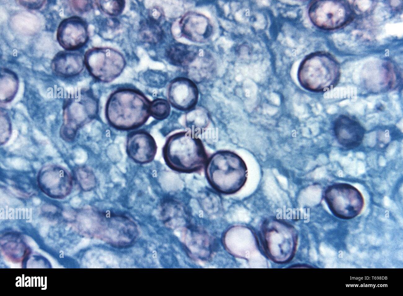 Histoplasma duboisii Banque de photographies et d’images à haute ...