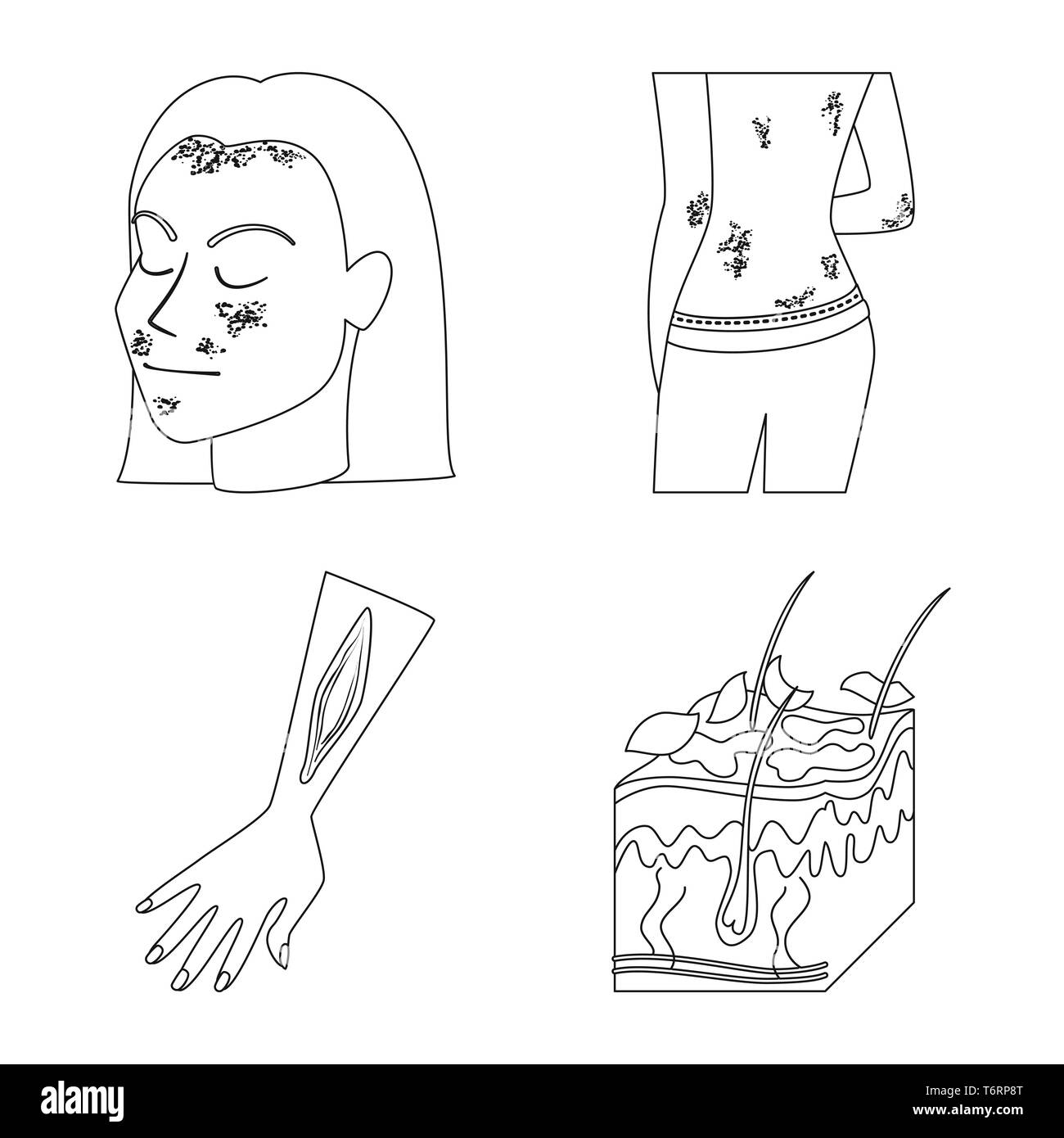 Le psoriasis,dommage,peau,bras,stress,épiderme,petit,body,,anatomie ...