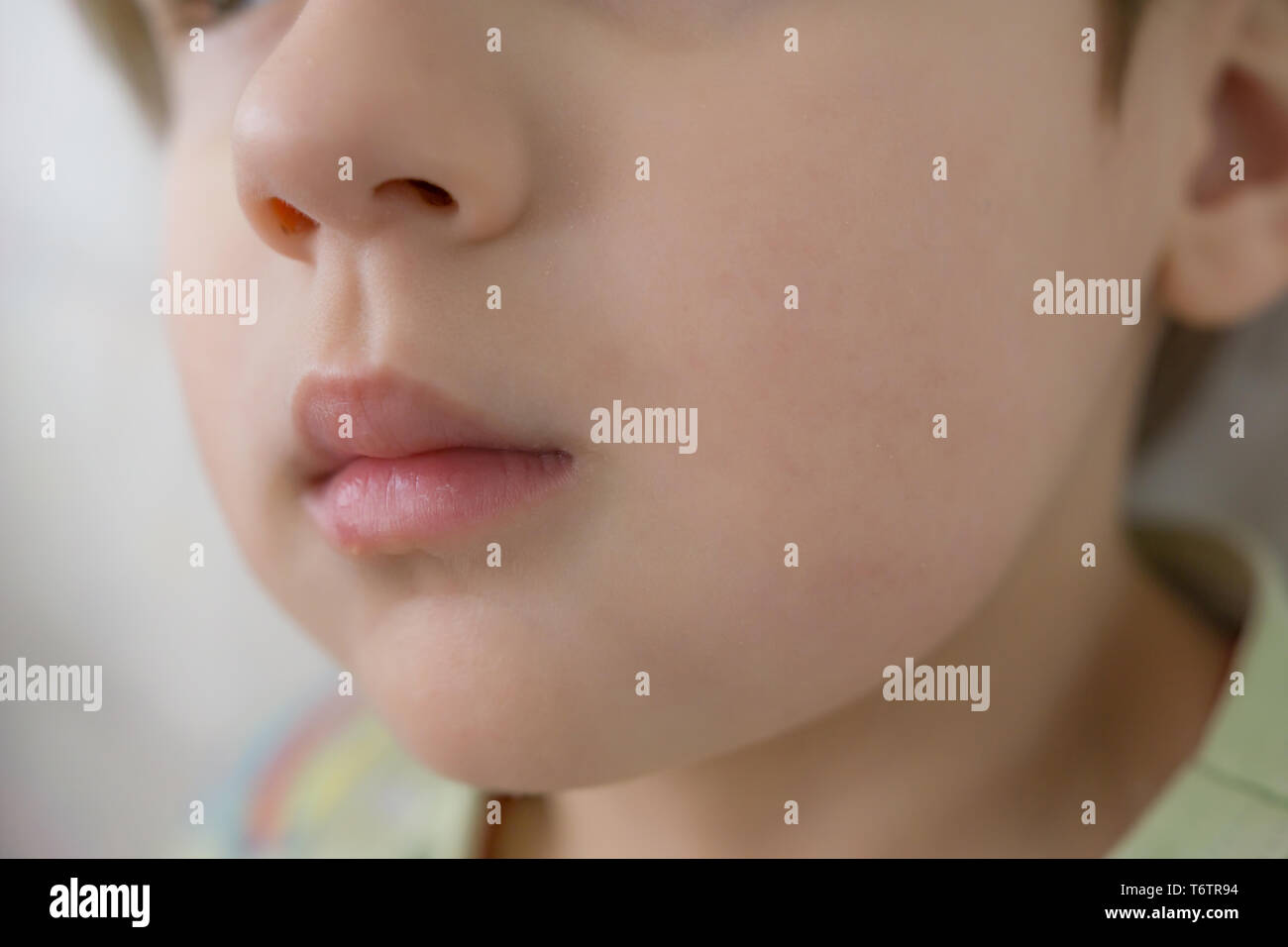 Joue gonflée Banque de photographies et d’images à haute résolution - Alamy