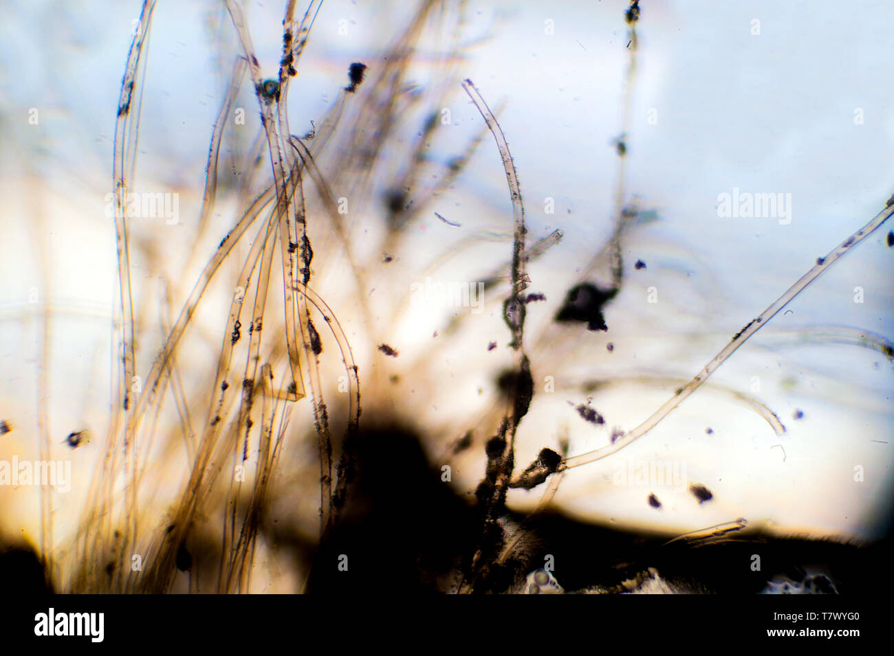 Champignions microscopiques Banque de photographies et d’images à haute ...
