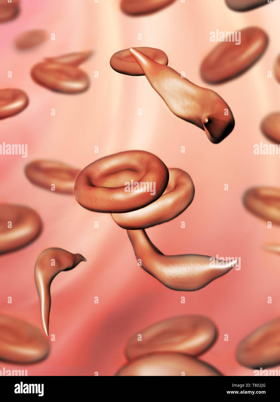 Sickle cells Banque de photographies et d’images à haute résolution - Alamy